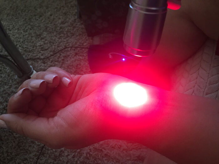 Cold Laser Therapy Pen LTP – 100P 660nm 150mw Portable Cold