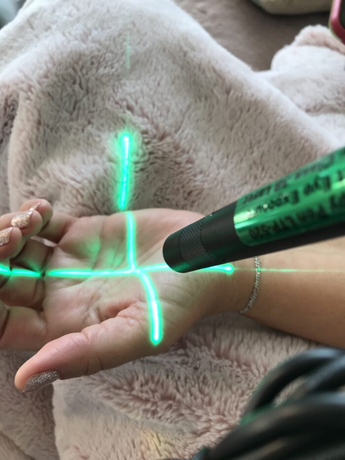 LTP-520 520nm Green Cold Laser - Energy Healer Steve | Cold Laser Therapy